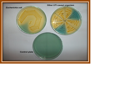 Comparative Study Between Different Types of Media used for the ...